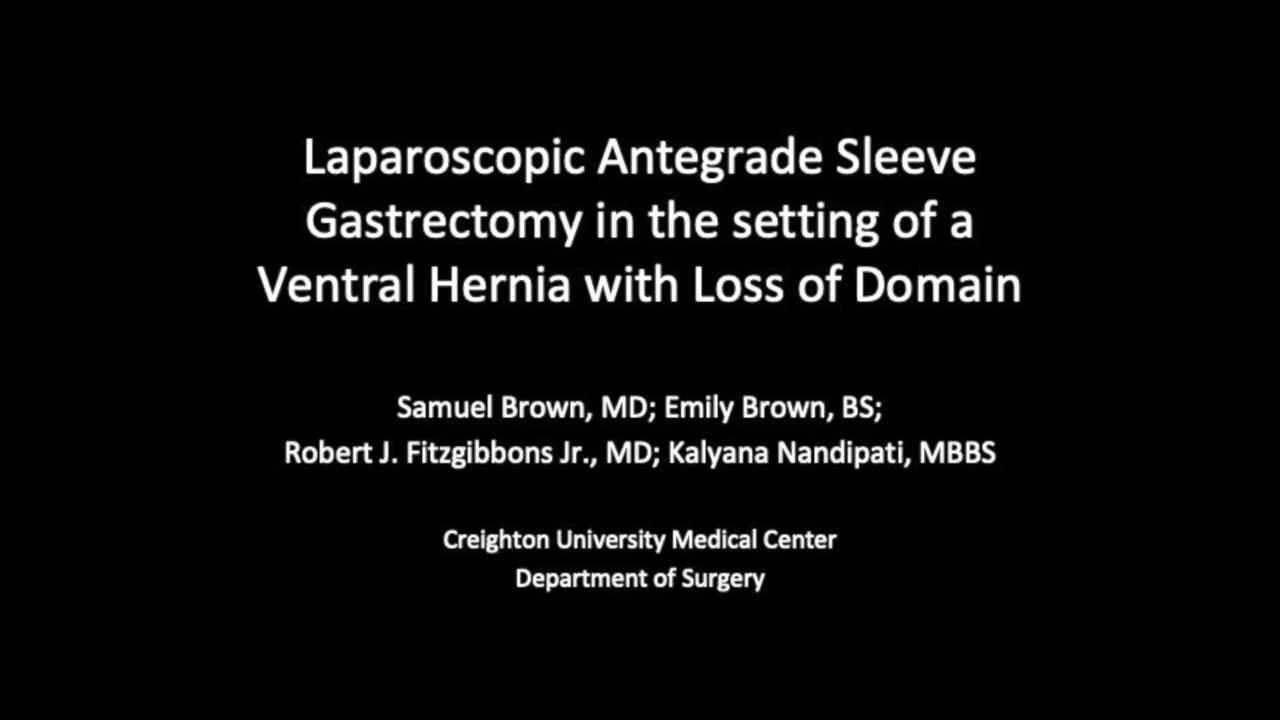 Laparoscopic Antegrade Sleeve Gastrectomy in the Setting of a Ventral ...