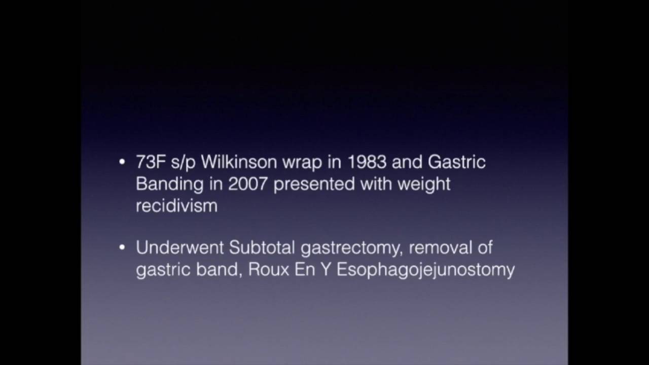 Wilkinson wrap conversion to roux-en-y gastric bypass - American ...