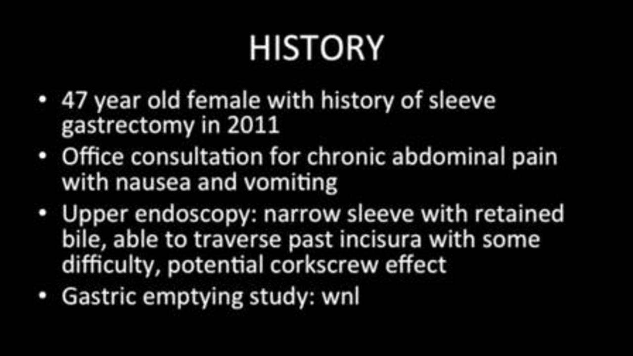 Laparoscopic Stricturoplasty for Gastric Sleeve Stenosis - American ...