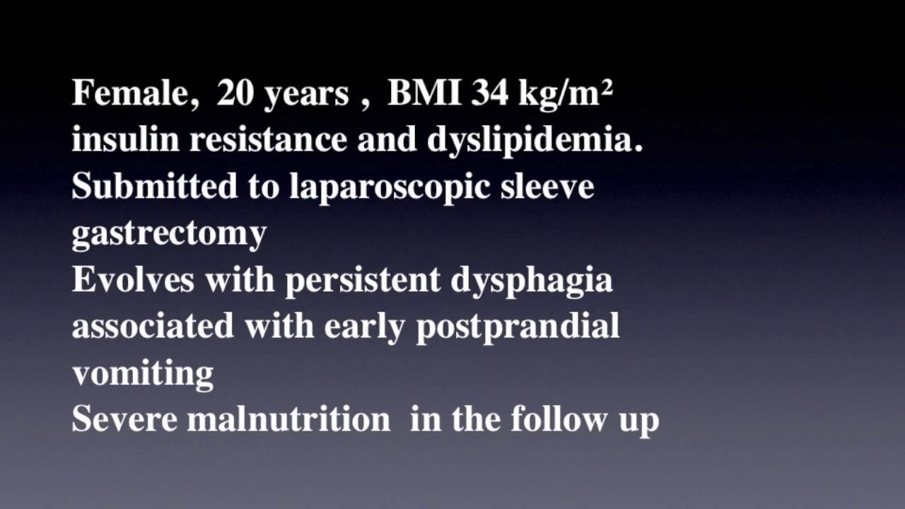 Distal sleeve gastrectomy obstruction due to remanent gastric fundus ...