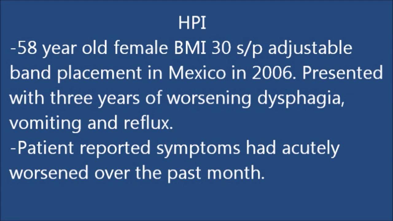 Laparoscopic revision of adjustable gastric band to toupet ...