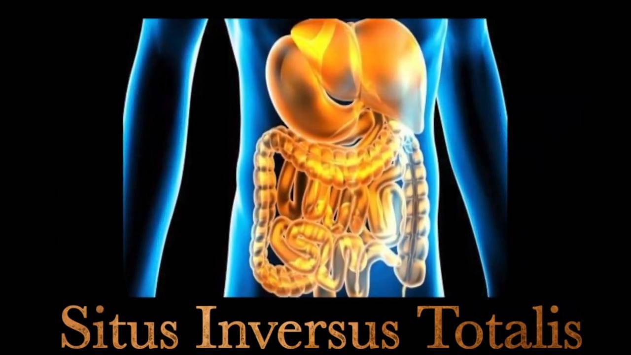 Laparoscopic stomach intestinal pylorus sparing surgery in patient with ...