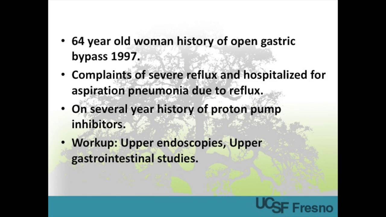 Nissen fundoplication over nondivided roux-en-Y gastric bypass for ...
