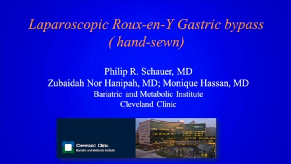 Standard Bariatric Procedure - American Society for Metabolic and ...