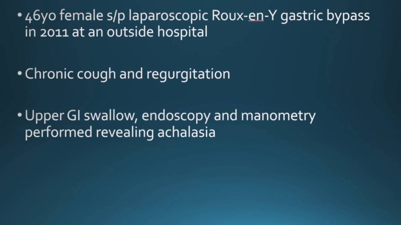 Laparoscopic heller myotomy after previous roux-en-y gastric bypass ...