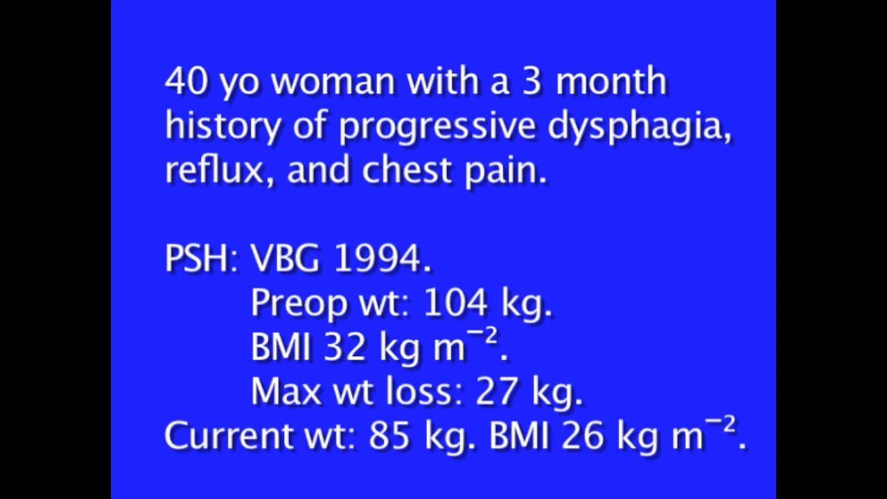 Laparoscopic heller myotomy and gastric bypass for achalasia following ...