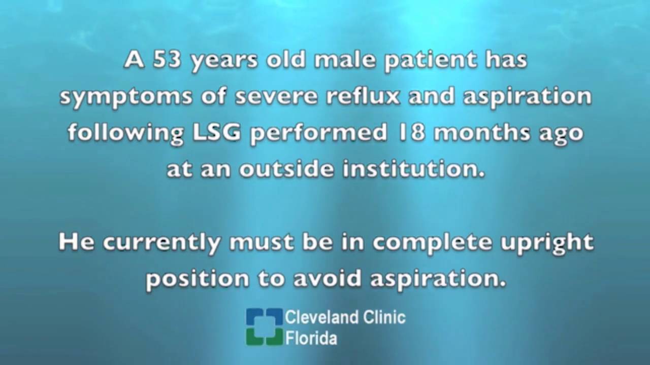 T tube gastrostomy as treatment modality for mucosal disruption after ...